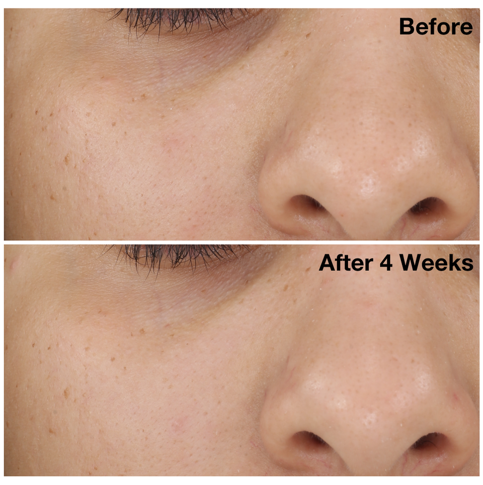 The Day Formula – Best Sun Creams for Face – Dr Rossi